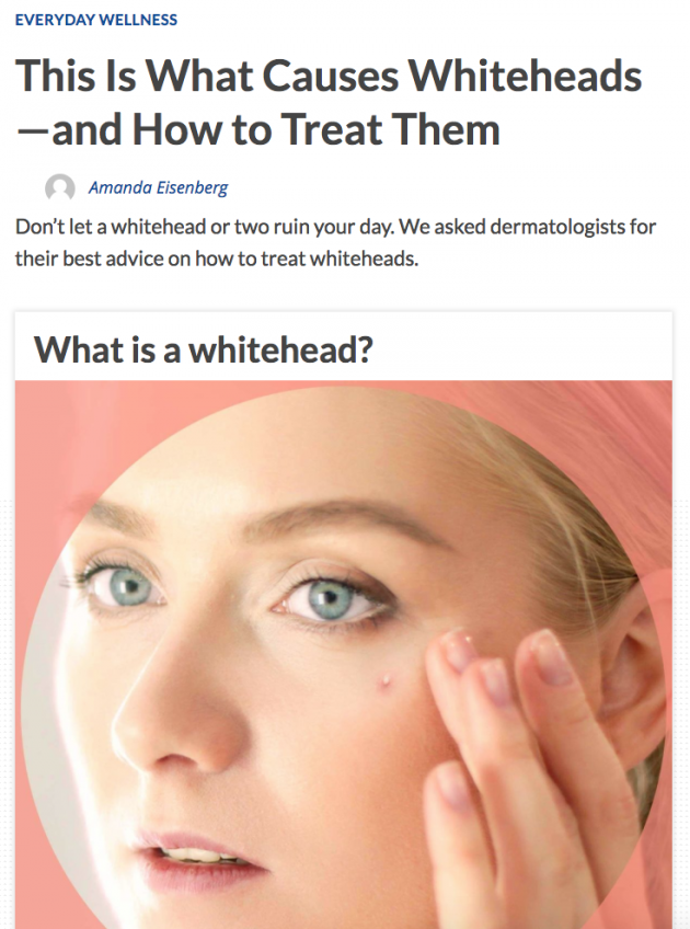 ava md press This Is What Causes Whiteheads—and How to Treat Them | Ava MD