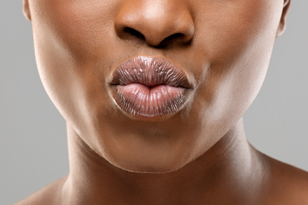 Fotona 4D Laser Lip Flip: Why You'll Love It Too | Ava MD