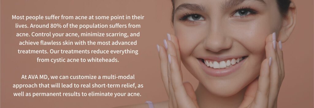 Acne Treatment Clinic | Ava MD